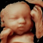Salud Materno Fetal y Ultrasonidos de Embarazo | ONNA Medical